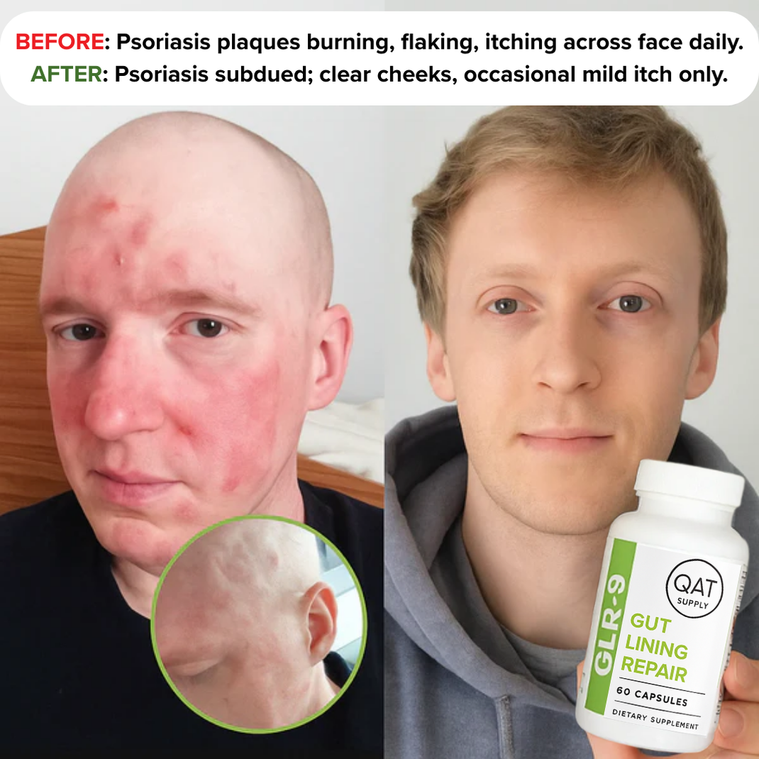 Gut Lining Repair 9 – QAT SUPPLY